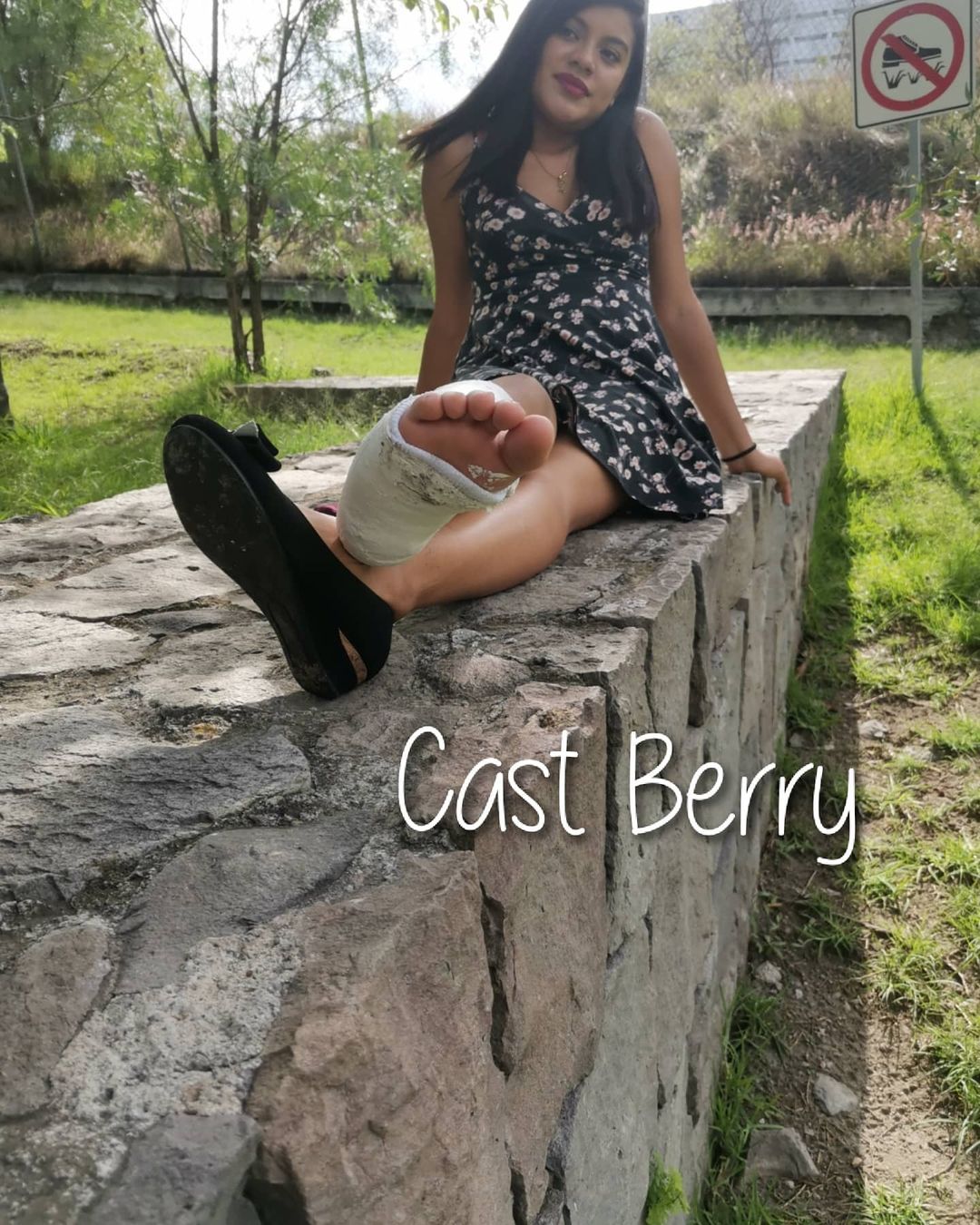 Cast Berry + Casts + Braces + Crutches | cnews