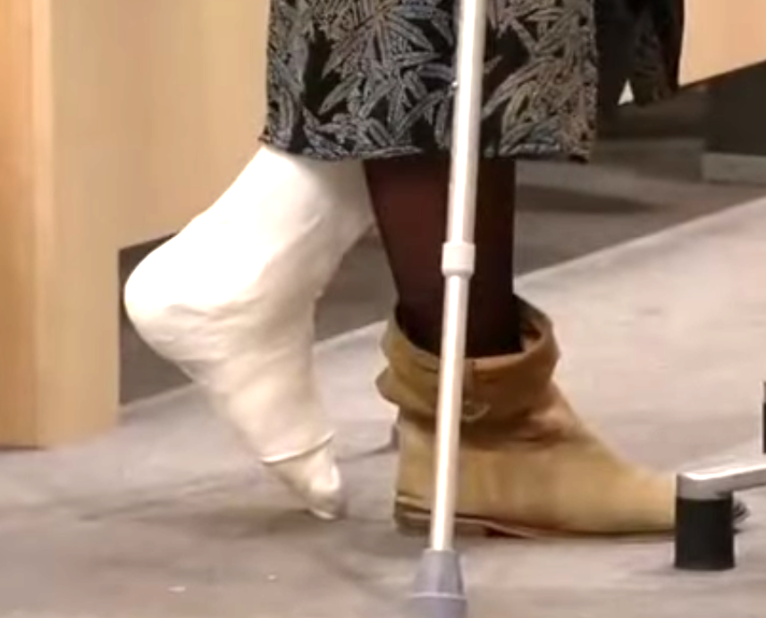 Classic plaster cast, full leg cast, crutches, LLC Broken leg, cast ...