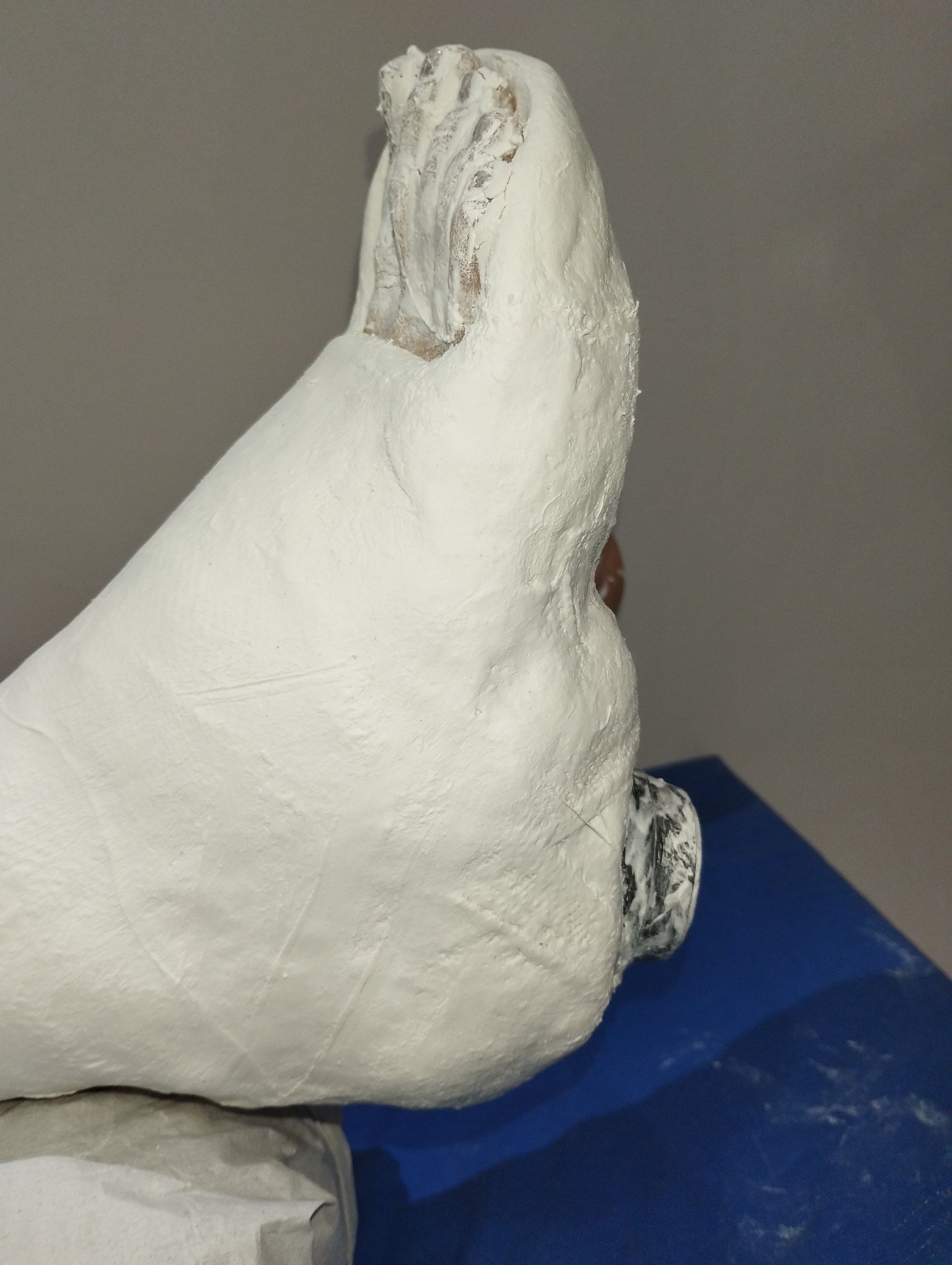 Hospital Plaster + Casts | cnews