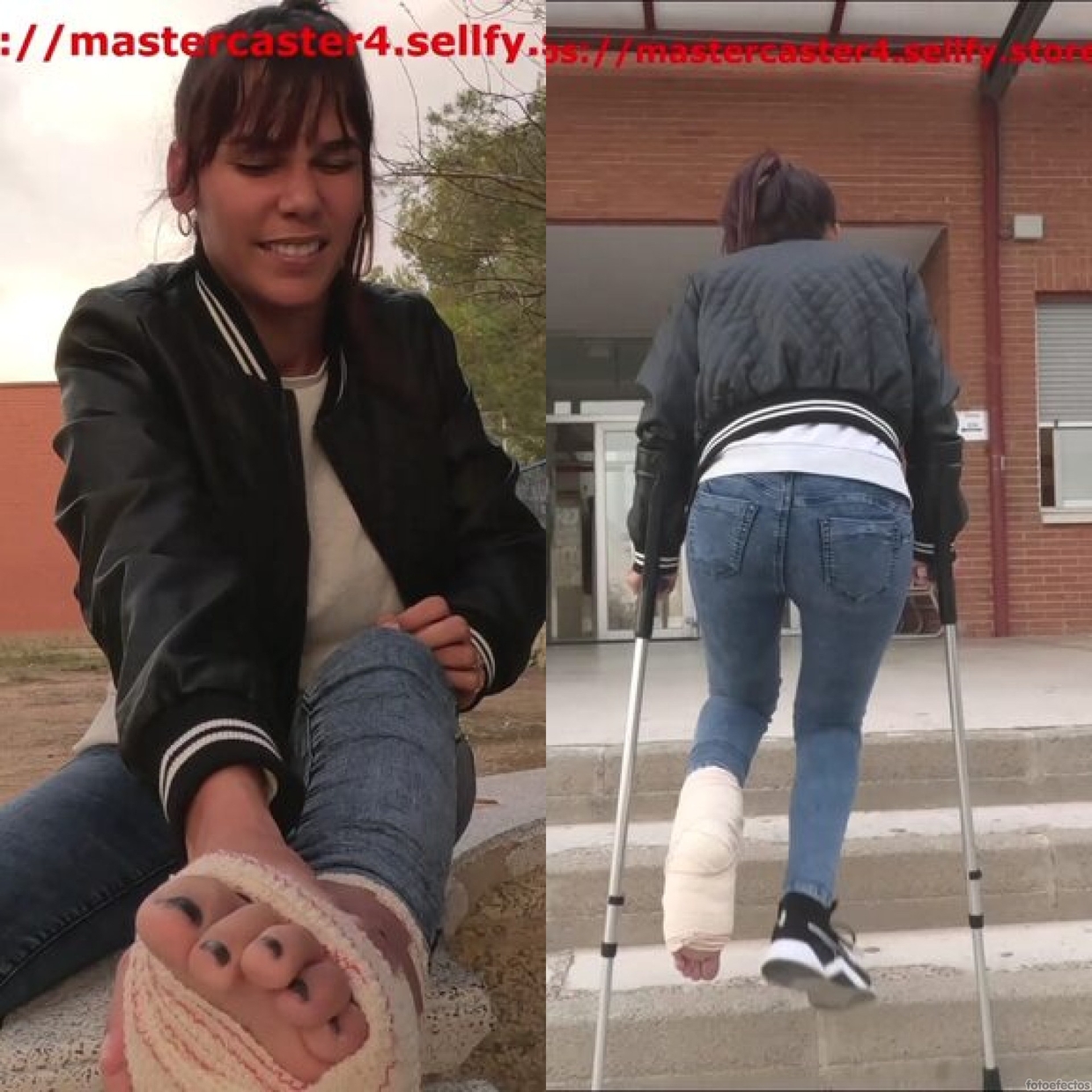 Huge bandage toes off crutching | cnews