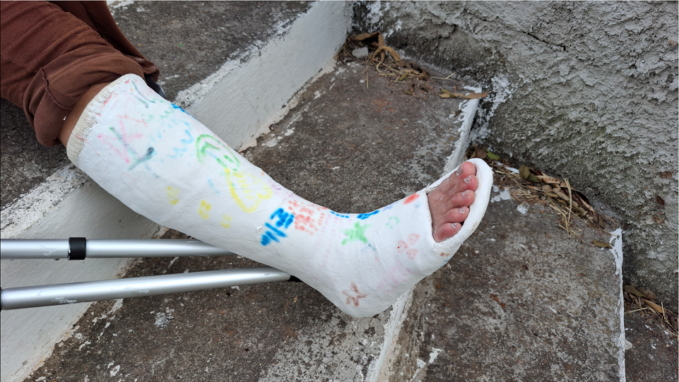 True Cast + Casts + Crutches | cnews