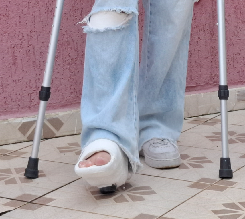 True Cast + Casts + Crutches | cnews