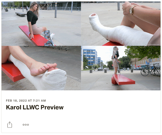 3 new clips: #1 Karol plaster full leg walking cast (LLWC) | cnews