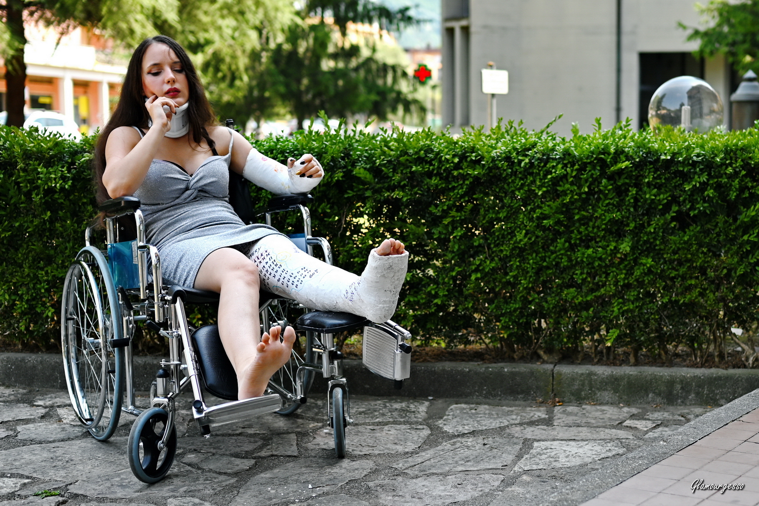 Alessia LLC+LAC - VIDEO 03: Telling you about my accident: Alessia is ...