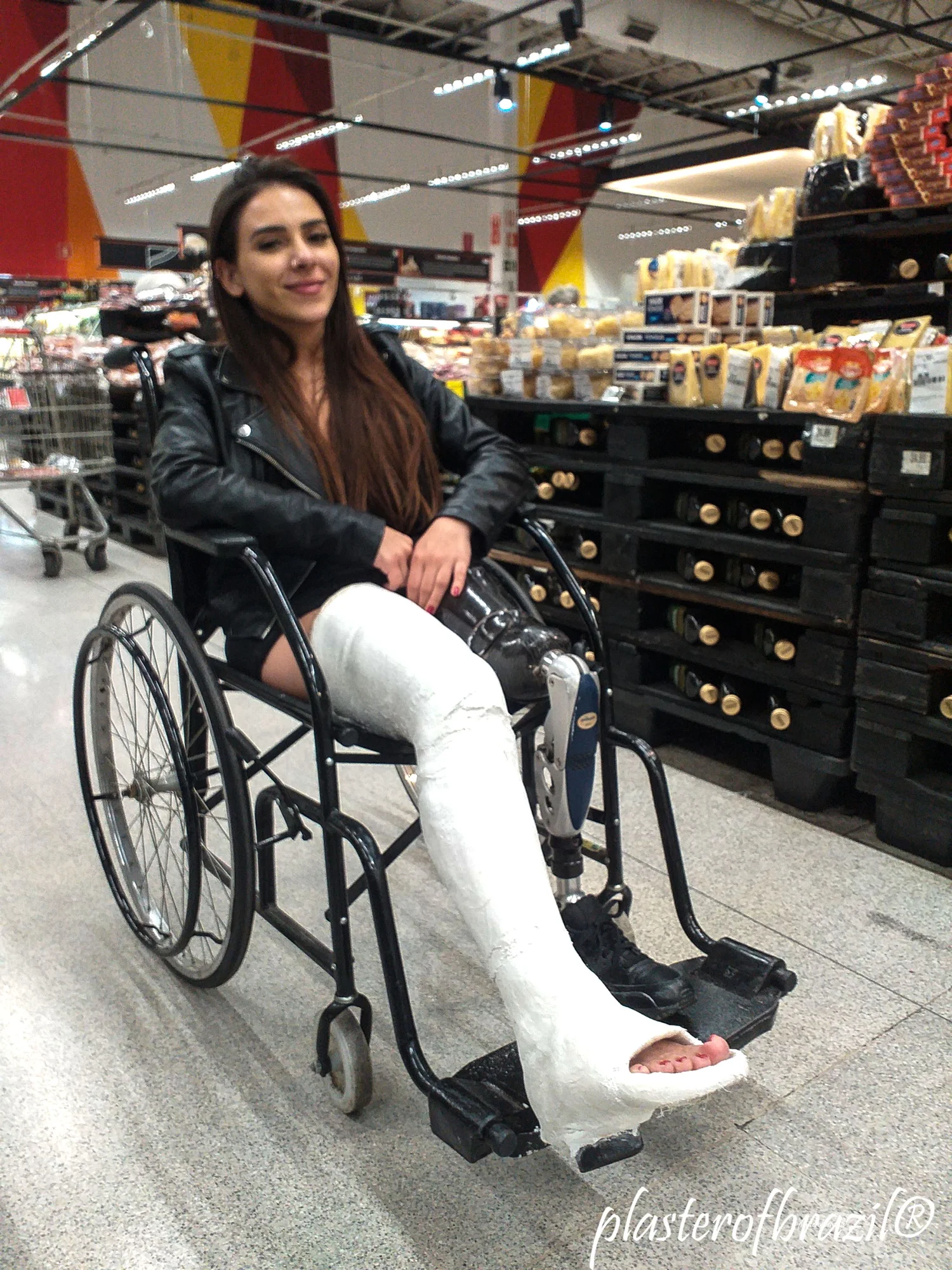 Plaster of Brazil + Casts + Crutches | cnews